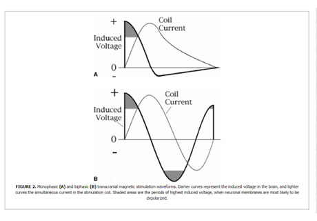 How Does TMS Work？ - Advanced TMS Manufacturer