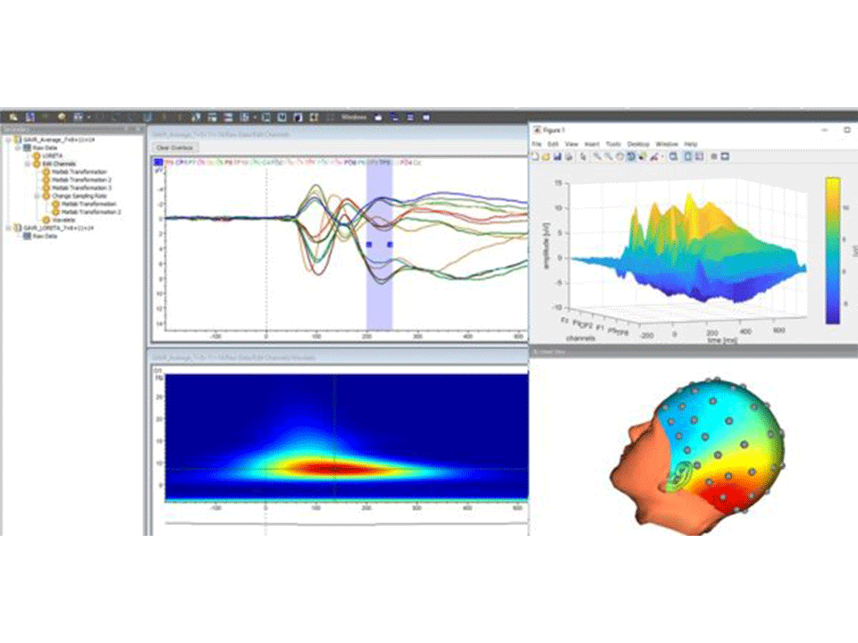 TMS-EEG - TMS Device Manufacturers
